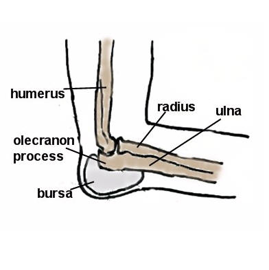 Bursitis of the Elbow