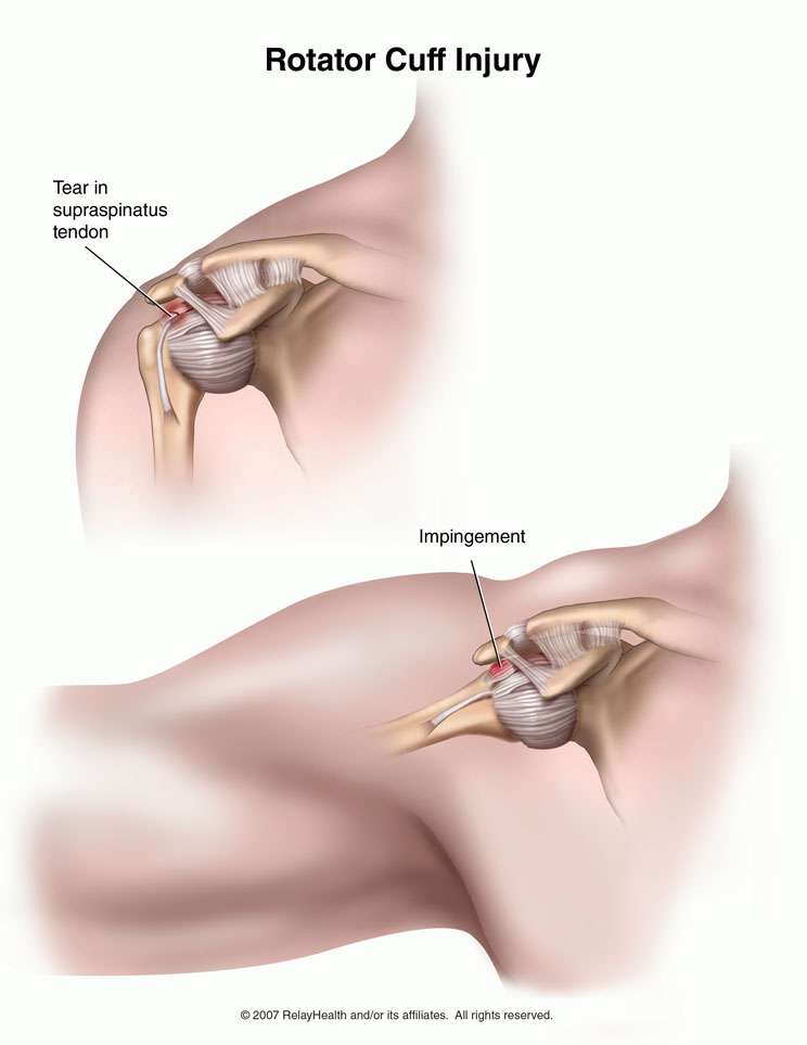 rotator cuff tendons