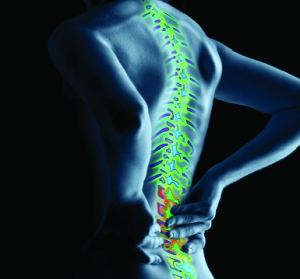 Low Back Pain Treated With Stem Cell Therapy - Dr. Dennis Lox Stem Cell ...