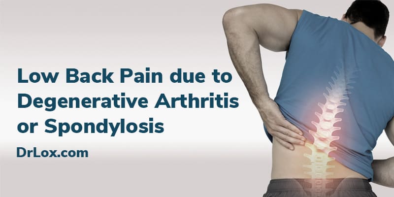 Low Back Pain due to Degenerative Arthritis or Spondylosis - Dr. Lox
